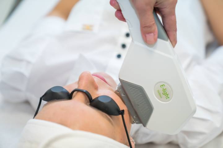 IPL epilace - Salonbeauty